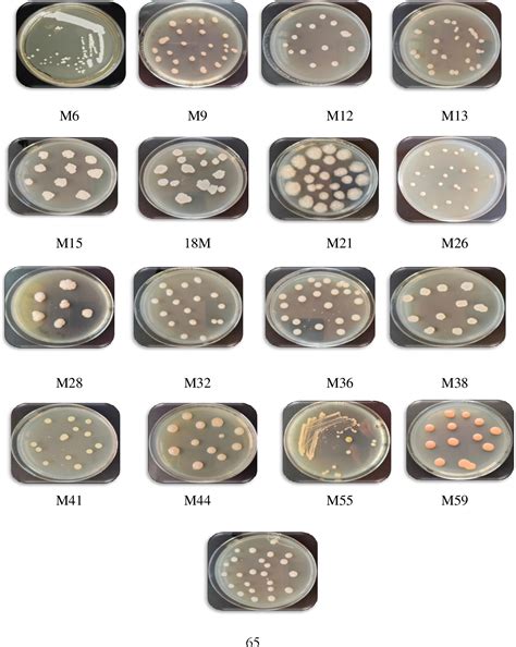 Figure 1 From Isolation And Identification Of Some Yeasts From Some Plants Semantic Scholar