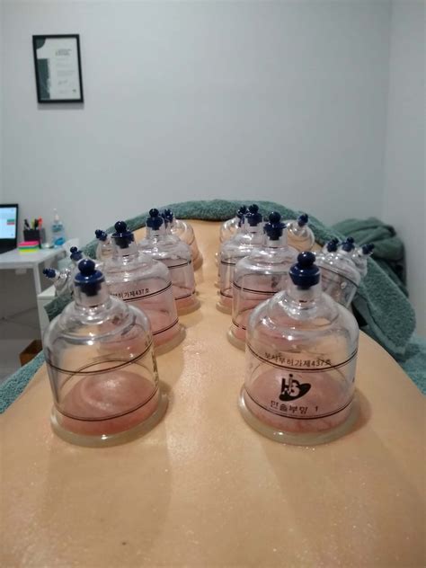 Myofascial Cupping In Adelaide Relieve Muscle Pain Sa