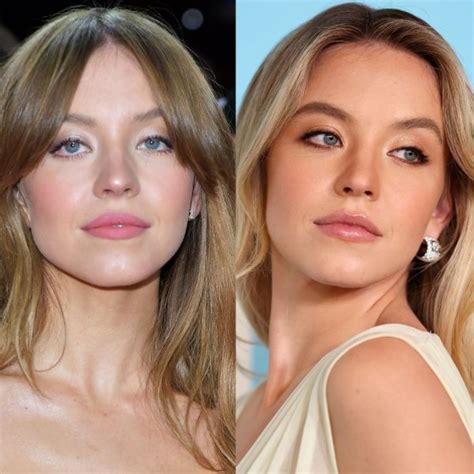 Young Celebrities Experts Believe Have Had Plastic Surgery Life And Style