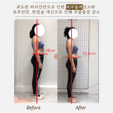 어스필라테스 다이어트 복부 둘레 감소 및 골반 전방경사 교정