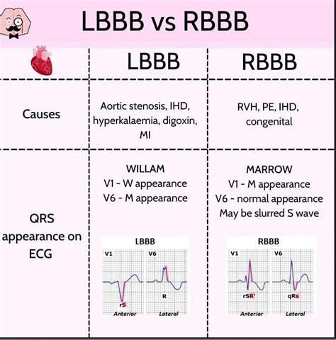 Lbbb Vs Rbbb Medizzy