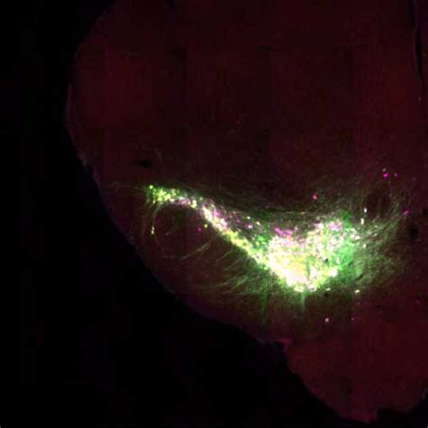 Semi Quantitative Histology Scoring
