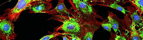 High Content Screening Imaging And Analysis Biocompare The Buyers Guide For Life Scientists