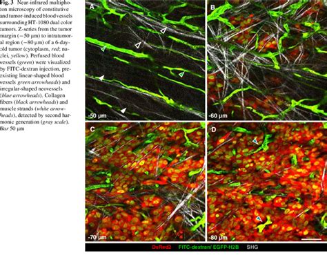 Near Infrared Multiphoton Microscopy Of Constitutive And Tumor Induced