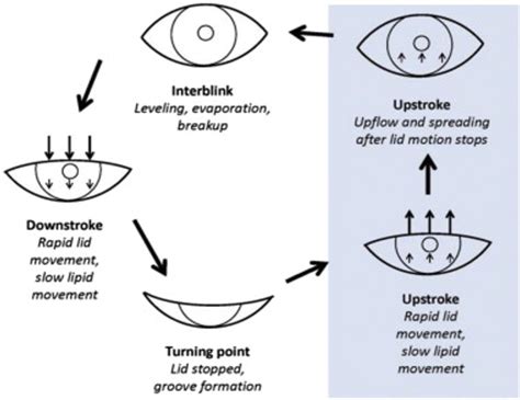 Dry Eye Diagnosis And Treatment Pacific Vision Care