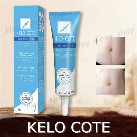 Jual Kelo Cote Gel 15gr Cream Bekas Luka Penghilang Bekas Luka Bekas Luka Shopee Indonesia