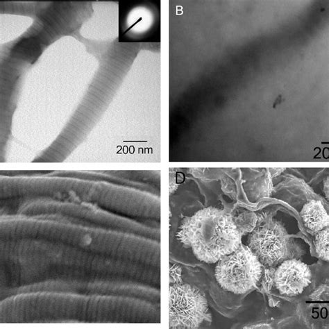 Fe Sem Micrographs Of Mineralized Collagen Fibrils Treated With 2 Download Scientific Diagram
