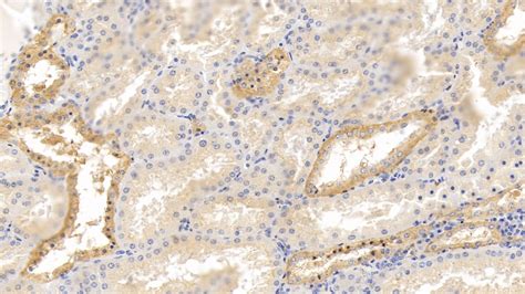Polyclonal Antibody To Glucocorticoid Induced Tumor Necrosis Factor
