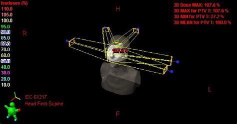 Beam Orientation For Imrt Plan Download Scientific Diagram