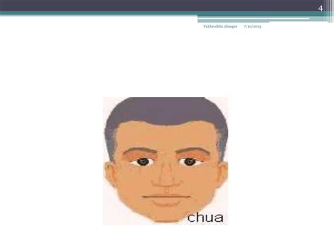 Classification Of Squint Pptx