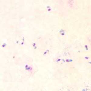 Cdc Dpdx Malaria