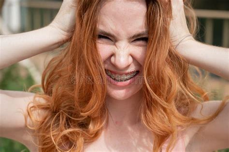 Close Up Portrait Of A Young Red Haired Woman With Braces On Her Teeth Girl Makes Faces At The