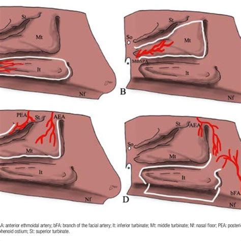 Harvesting Of Lateral Nasal Wall Flaps Posterior Pedicle Inferior