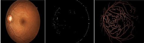 a input image b pre processed image c segmentation results