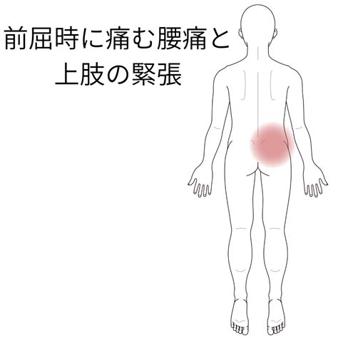 重いものを背負うと腰が痛い｜臀部痛、腰痛のツボ｜ツボネット 鍼灸の症例が検索できるツボ辞典