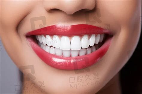 常德美奥口腔医院口碑评价怎么样？患者盛赞服务技术双优 口腔久灵