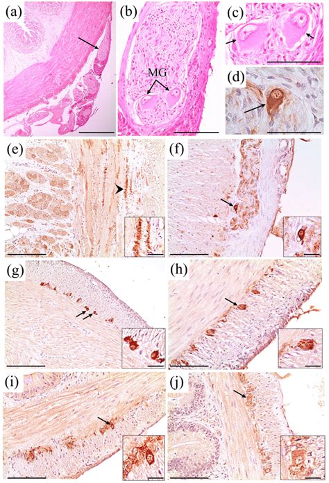Photomicrography Of The Myenteric Plexus And Peptide Immunoreactivity Download Scientific