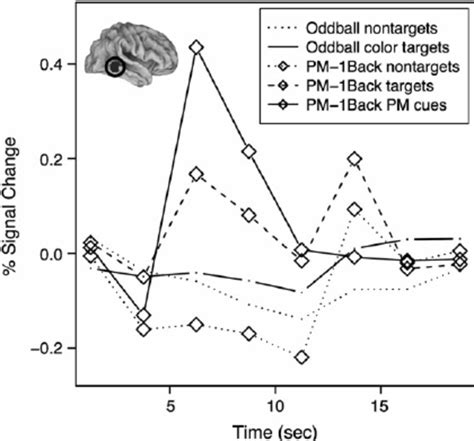 Pattern Of Response In A Region Of Right Middle Temporal Cortex Each Download Scientific