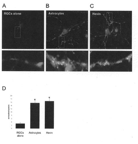 Modulation Of Synaptogenesis Eureka Patsnap