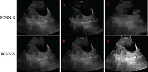 bcnn r and bcnn s feature images a the activation region shown in download scientific