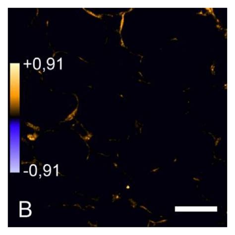 The Principle Of The Duolink Proximity Ligation Assay A Binding Of Download Scientific