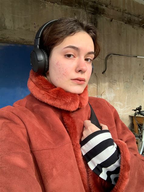 Pretty People Beautiful People Girl With Acne Acne Makeup Bare Beauty Skin Relief Fire