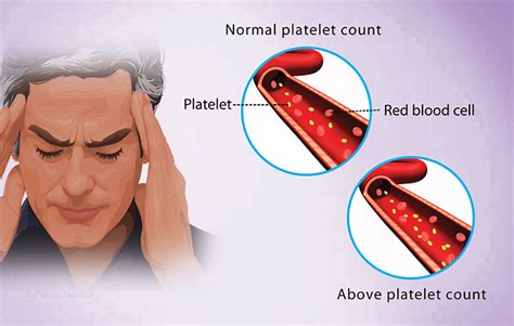 Health Condition Symptoms Causes Treatment And More