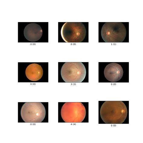 Diabeticretinopathydetection Tensorflow Datasets