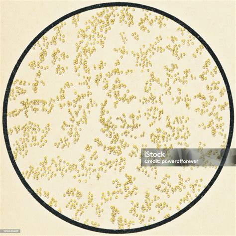 Microscopic View Of Sodium Urate In Human Urine 19th Century Stock