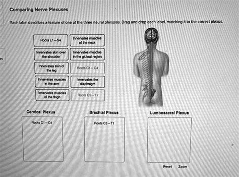 SOLVED 41 Comparing Nerve Plexuses Each Label Describes A Feature Of
