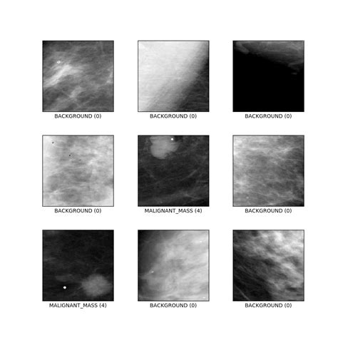 Curated Breast Imaging Ddsm TensorFlow Datasets