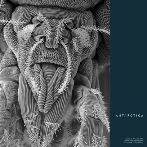 Electron Microscope X1500 Mite Rmicroscopy