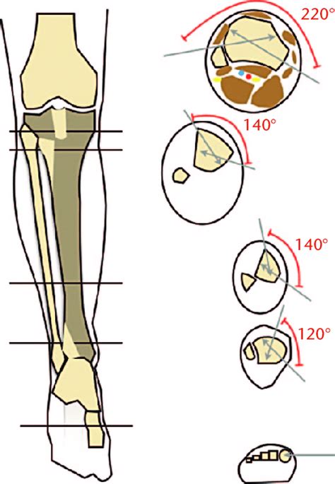 Safe Zones For Inserting Pins In The Region Of The Tibia At The Download Scientific Diagram