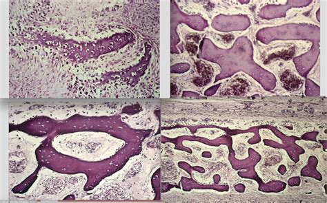 Diagram Of Intramembranous Ossification Quizlet