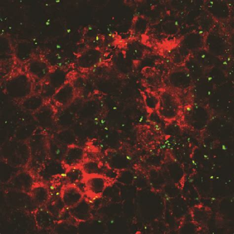 Scientific And Clinical Applications Of Magnetic Carriers