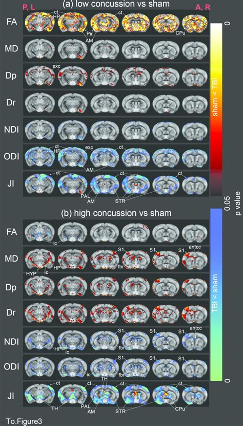 Voxel By Voxel Statistical Analysis Results Of Diffusion Tensor Imaging Download Scientific