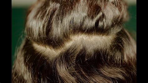 All You Need To Know About Your Scalp And Hair Youtube