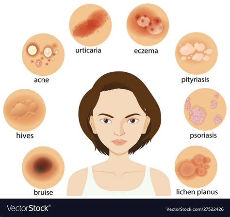 Types Of Skin Conditions