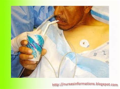 Nasogastric Tube NGT Insertion And Removal PPS