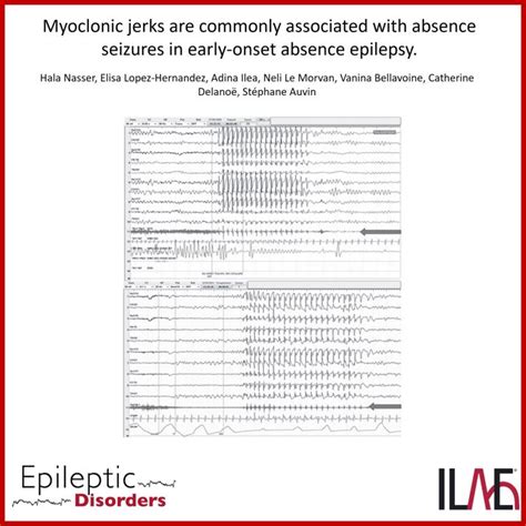 Epileptic Disorders On Linkedin Nasser Et Al Describe Electroclinical Features Of Early Onset