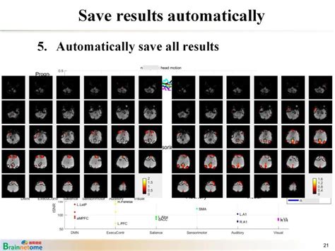 Doc联盟交流会（2）：意识障碍疾病的个体化脑功能网络分析与预后预测及工具研究 脑医汇