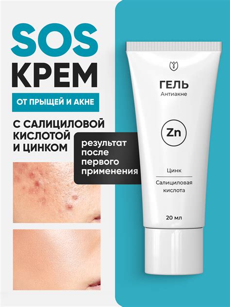 Мазь для заживления прыщей и следов от них — купить по низкой цене на Яндекс Маркете