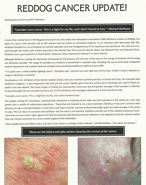 Cbd Oil For Skin Cancer Cancerwalls