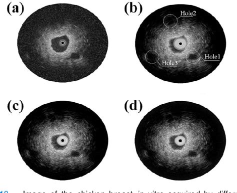 Figure 10 From An Improved Chirp Coded Excitation Based On Compression Pulse Weighting Method In