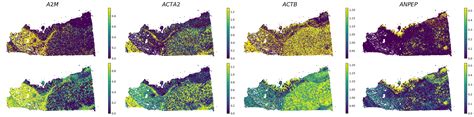 Spatial Transcriptome Xenium — Recode 021 Documentation