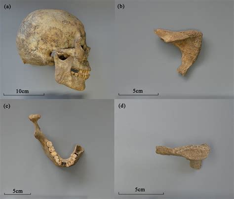 Determination Of Age And Sex A Skull Characteristics B Subpubic