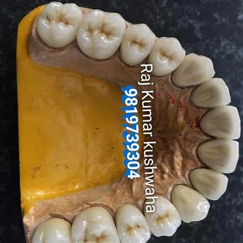 Raj Kumar Kushwaha On Linkedin My Work