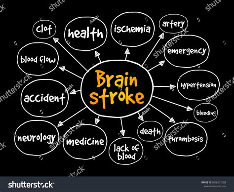 Brain Stroke Mind Map Medical Concept เวกเตอร์สต็อก ปลอดค่าลิขสิทธิ์