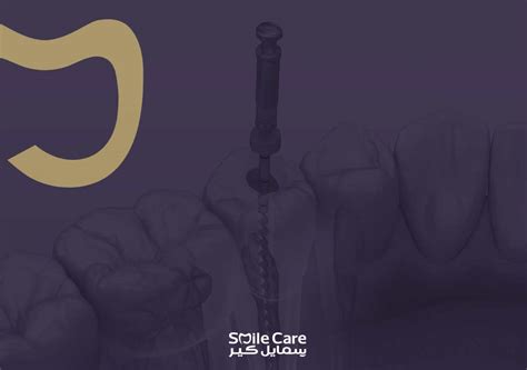 سمايل كير Smile Careعلاج جذور وأعصاب الأسنان