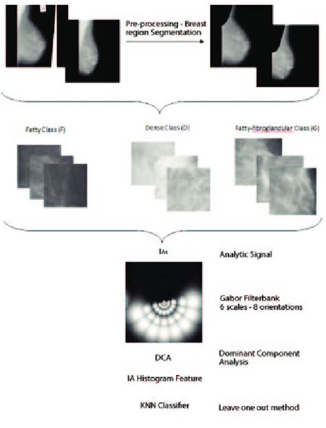 Breast Density Classification Presented Methodology Download Scientific Diagram